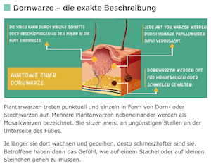 Dornwarzen E-Book